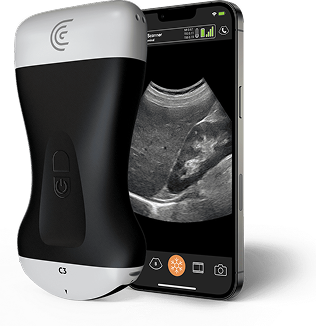 LifeSemantics x Clarius